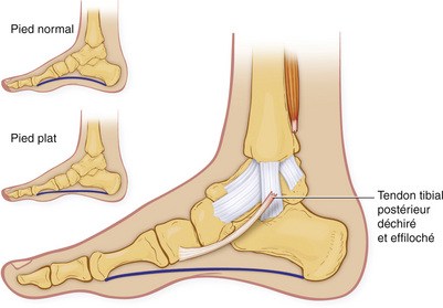 Pied - Cabinet Olagnier Pédicurie Podologie